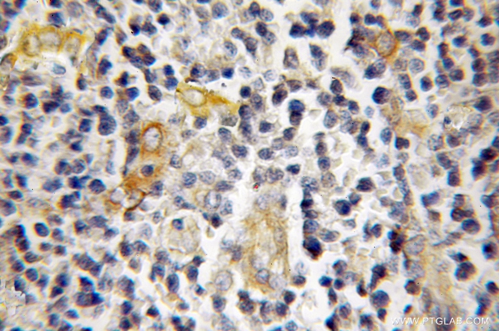 PTGLab - HAX1 Antibody 11266-1-AP
