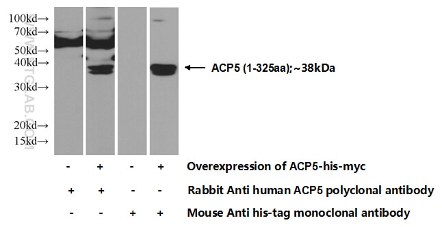 ACP5 Antibody 11594-1-AP | Proteintech