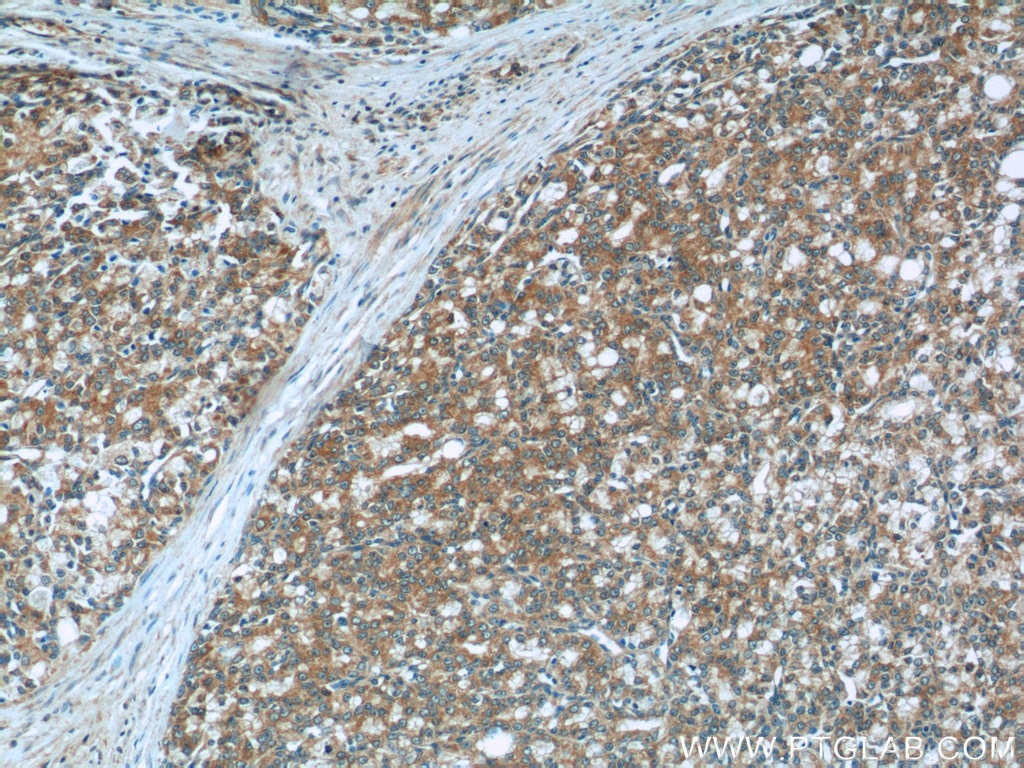 ACSM3 antibody (10168-2-AP) | Proteintech