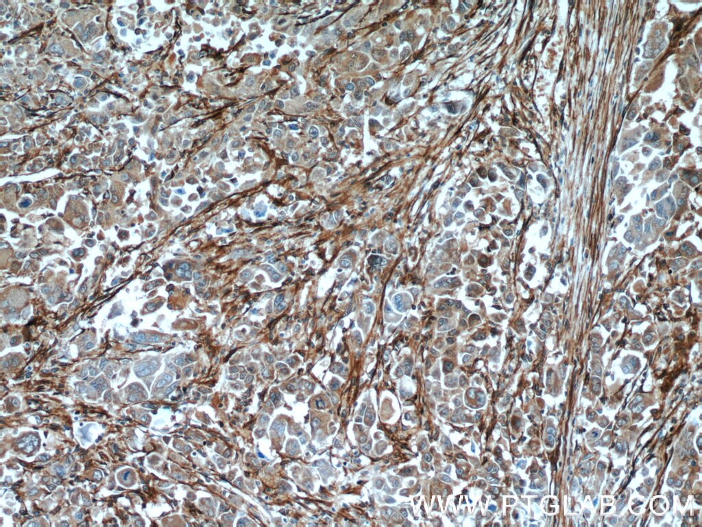 ACTA2/smooth muscle actin Antibody 14395-1-AP | Proteintech