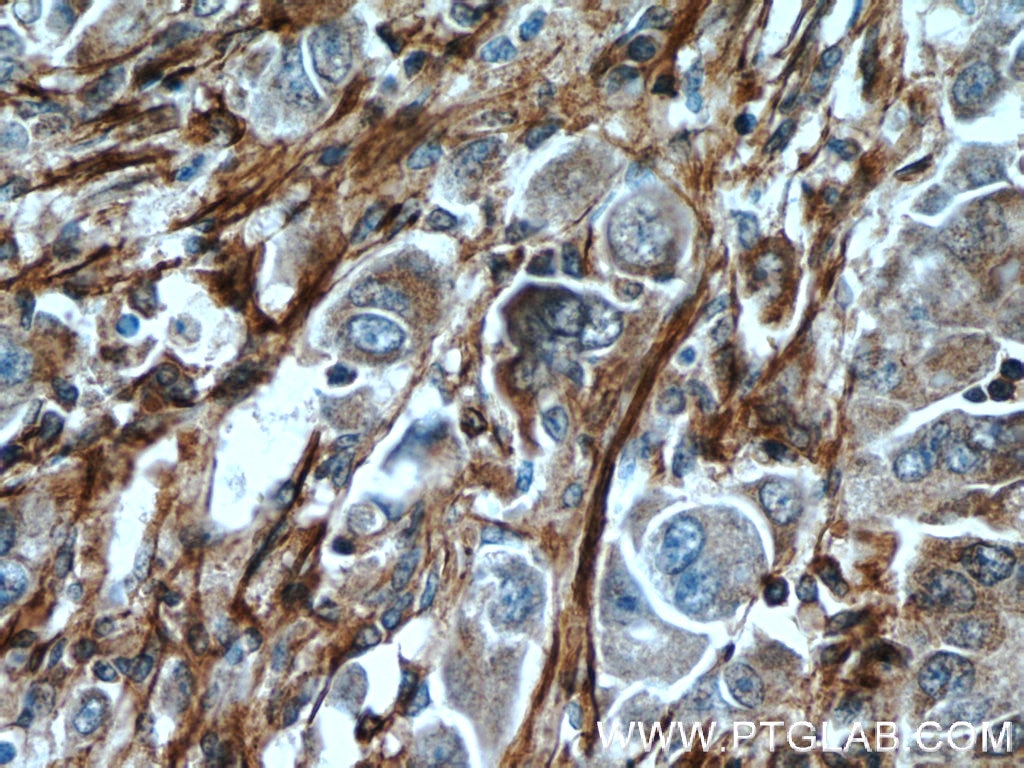 ACTA2/smooth muscle actin Antibody 14395-1-AP | Proteintech