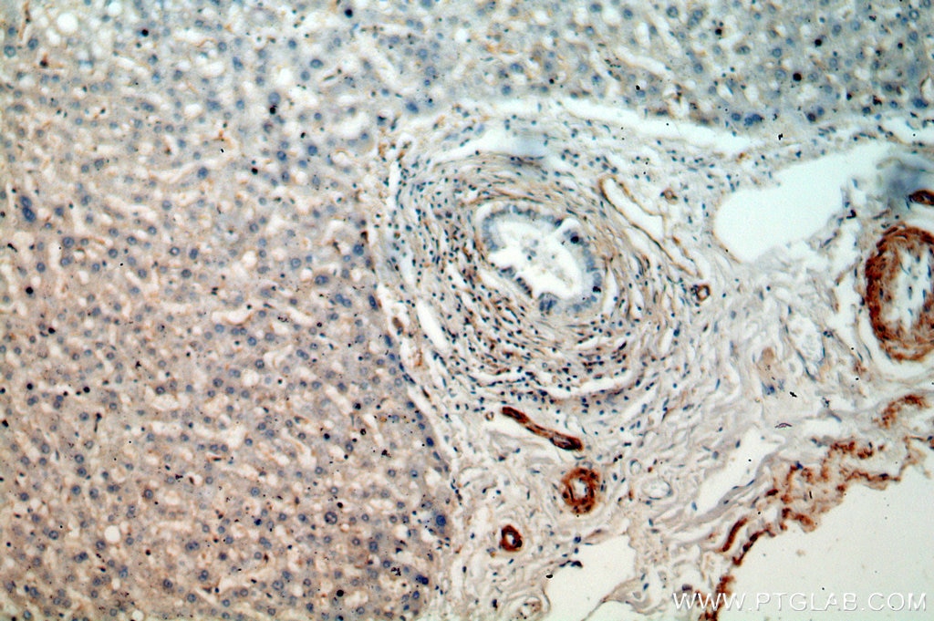 ACTA2/smooth muscle actin Antibody 14395-1-AP | Proteintech