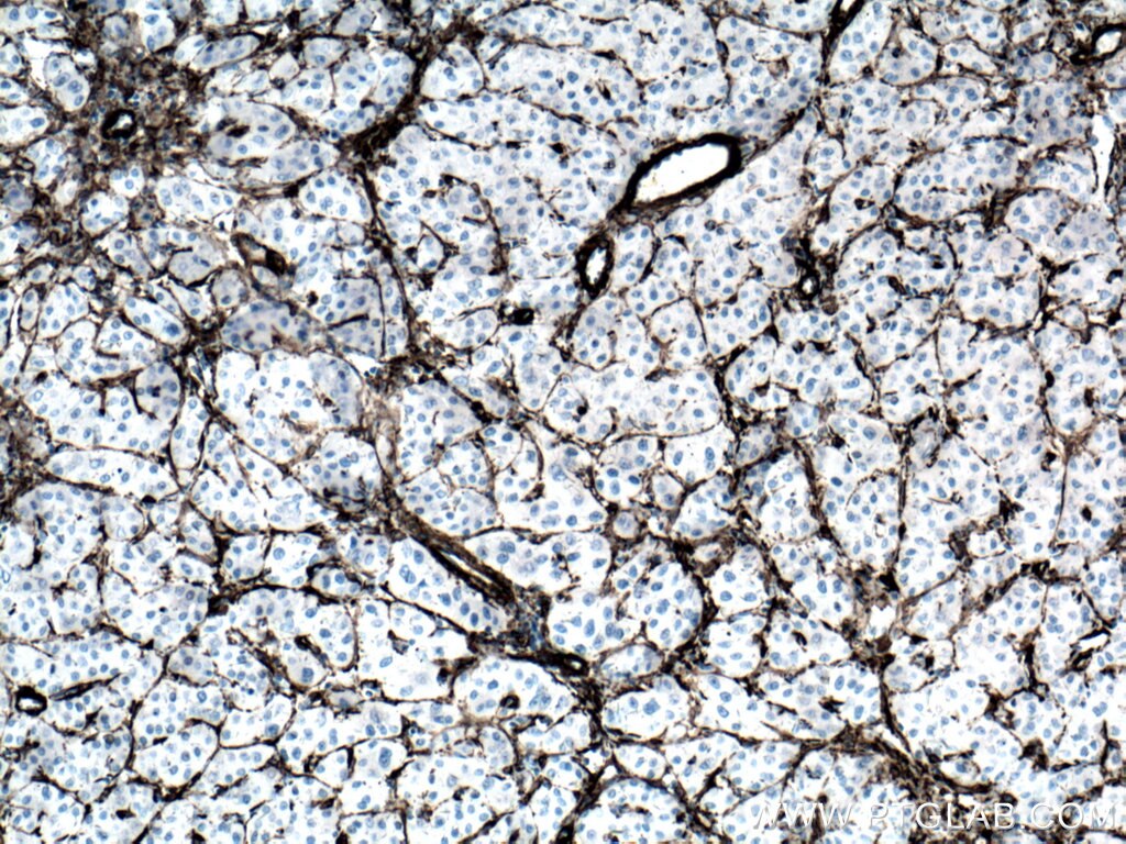 ACTA2/smooth muscle actin Antibody 23081-1-AP | Proteintech