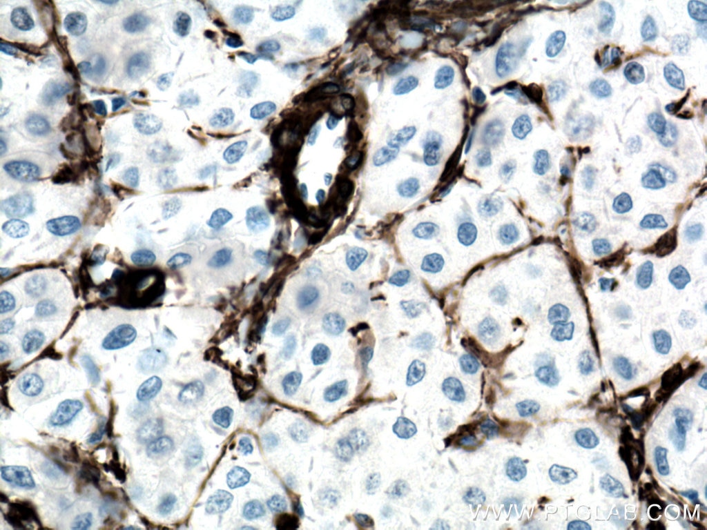 ACTA2/smooth muscle actin Antibody 23081-1-AP | Proteintech