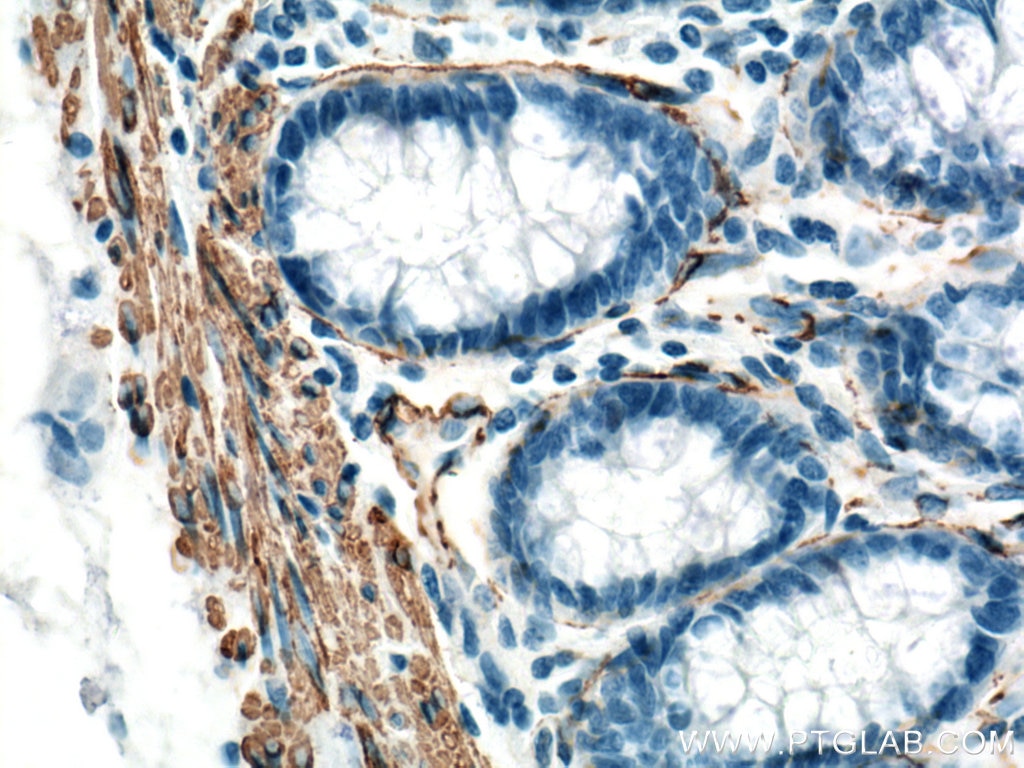 smooth muscle actin antibody (23081-1-AP) | Proteintech