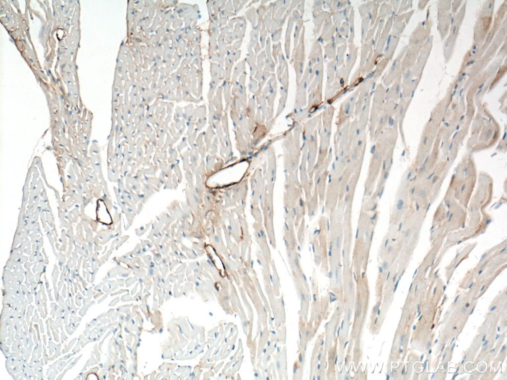 ACTA2/smooth muscle actin Antibody 23081-1-AP | Proteintech
