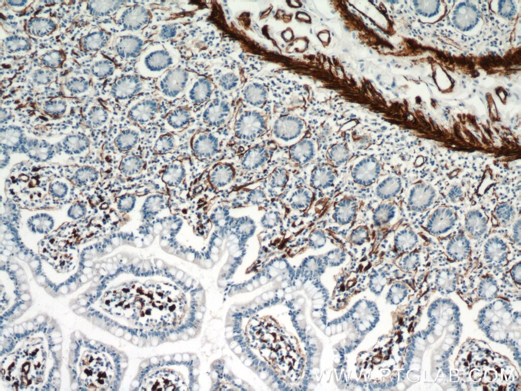 ACTA2/smooth muscle actin Antibody 23081-1-AP | Proteintech