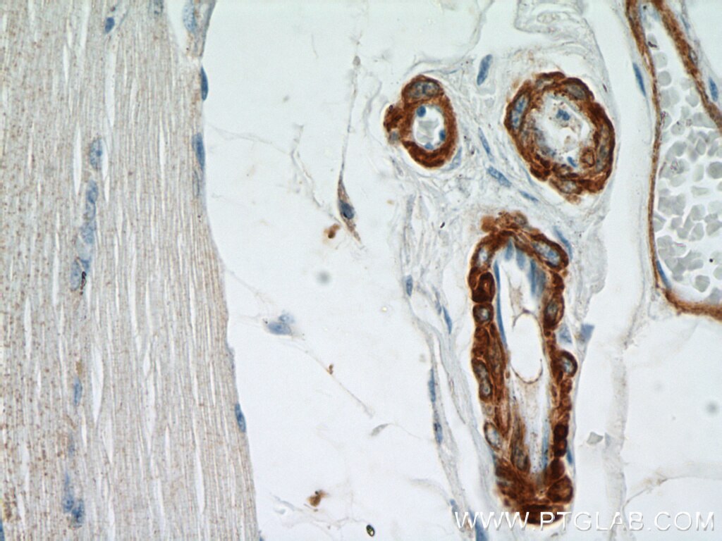 ACTA2/smooth muscle actin Antibody 23081-1-AP | Proteintech