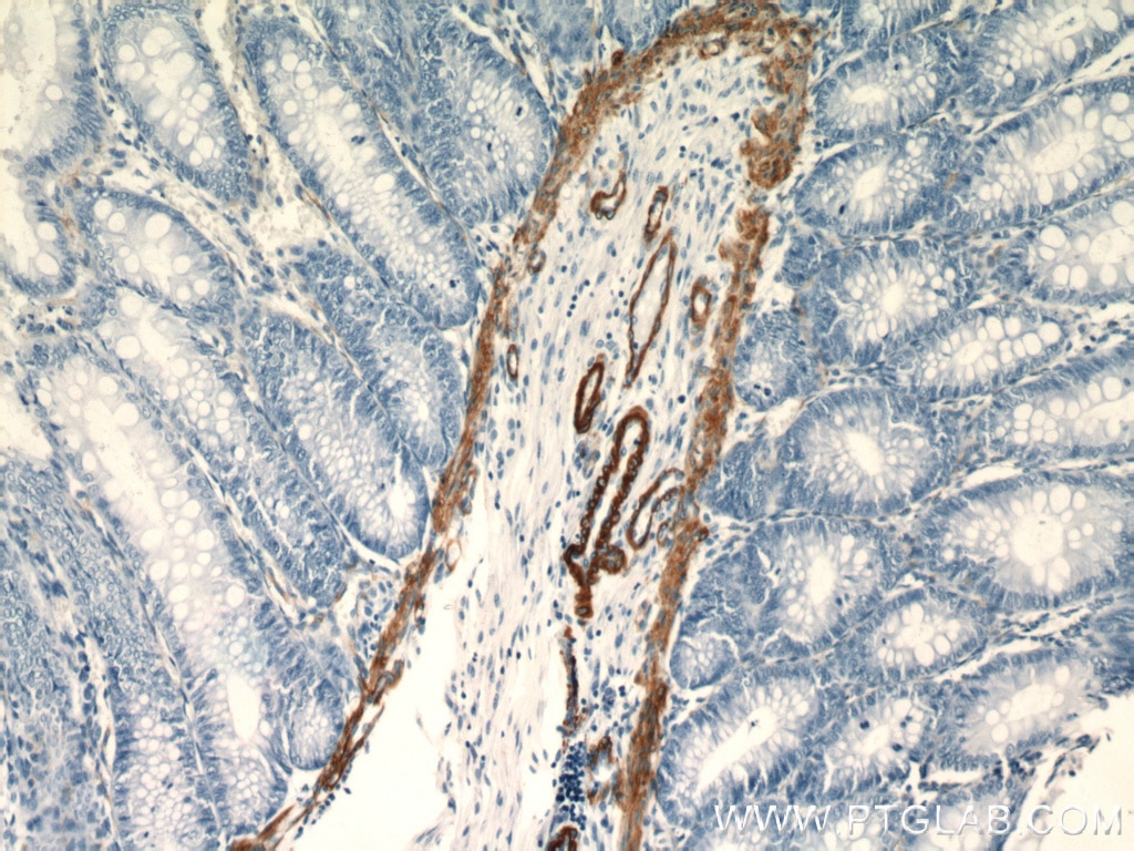 ACTA2/smooth muscle actin Antibody 23081-1-AP | Proteintech