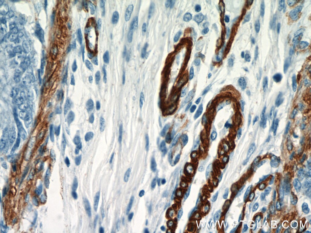 ACTA2/smooth muscle actin Antibody 23081-1-AP | Proteintech