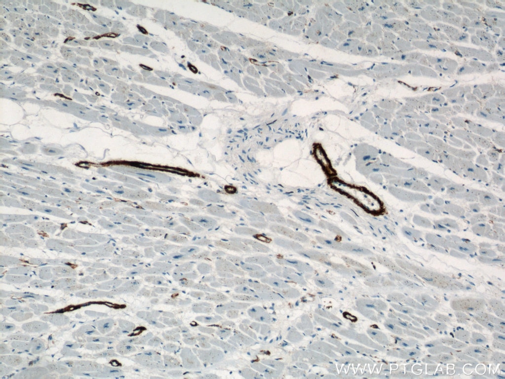 ACTA2/smooth muscle actin Antibody 23081-1-AP | Proteintech