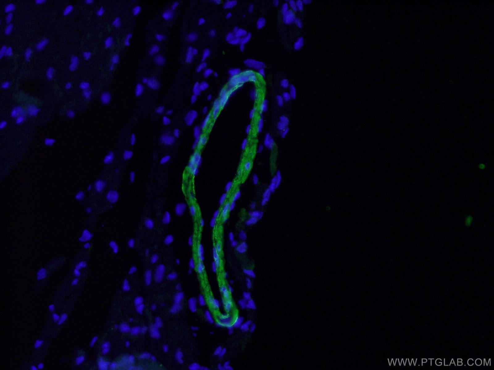 Alpha SMA-specific Antibody 55135-1-AP | Proteintech