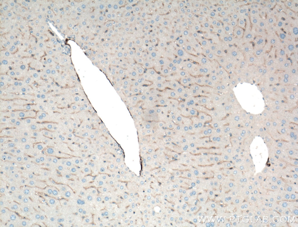 smooth muscle actin specific antibody (55135-1-AP) | Proteintech