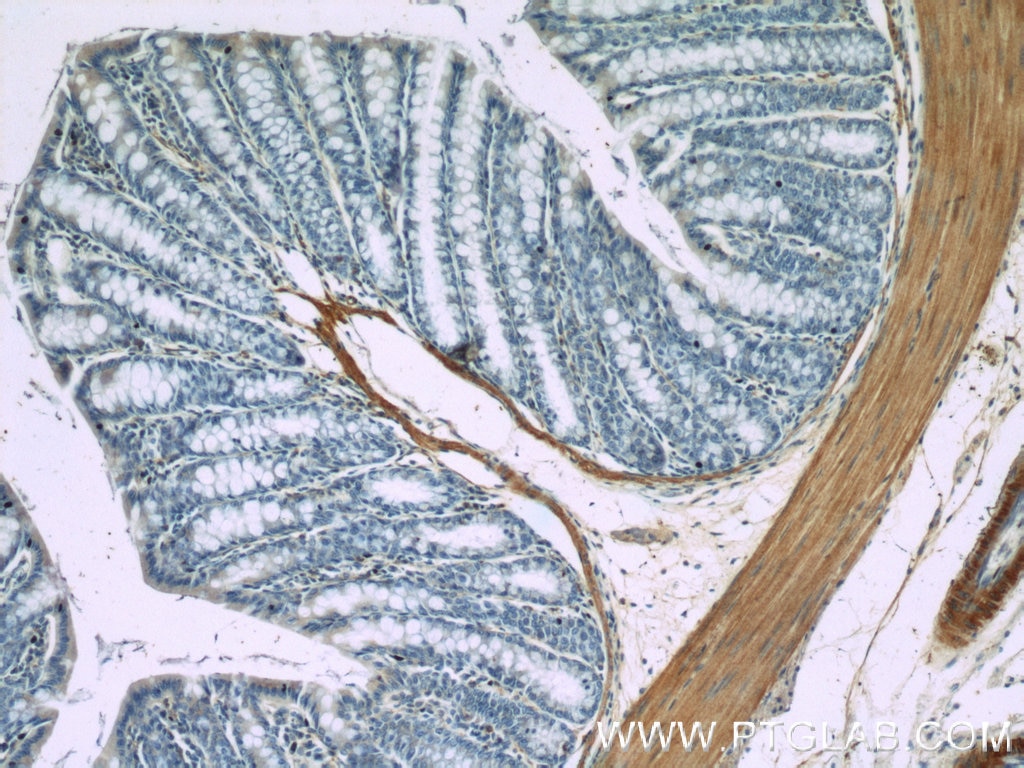 Alpha SMA-specific Antibody 55135-1-AP | Proteintech
