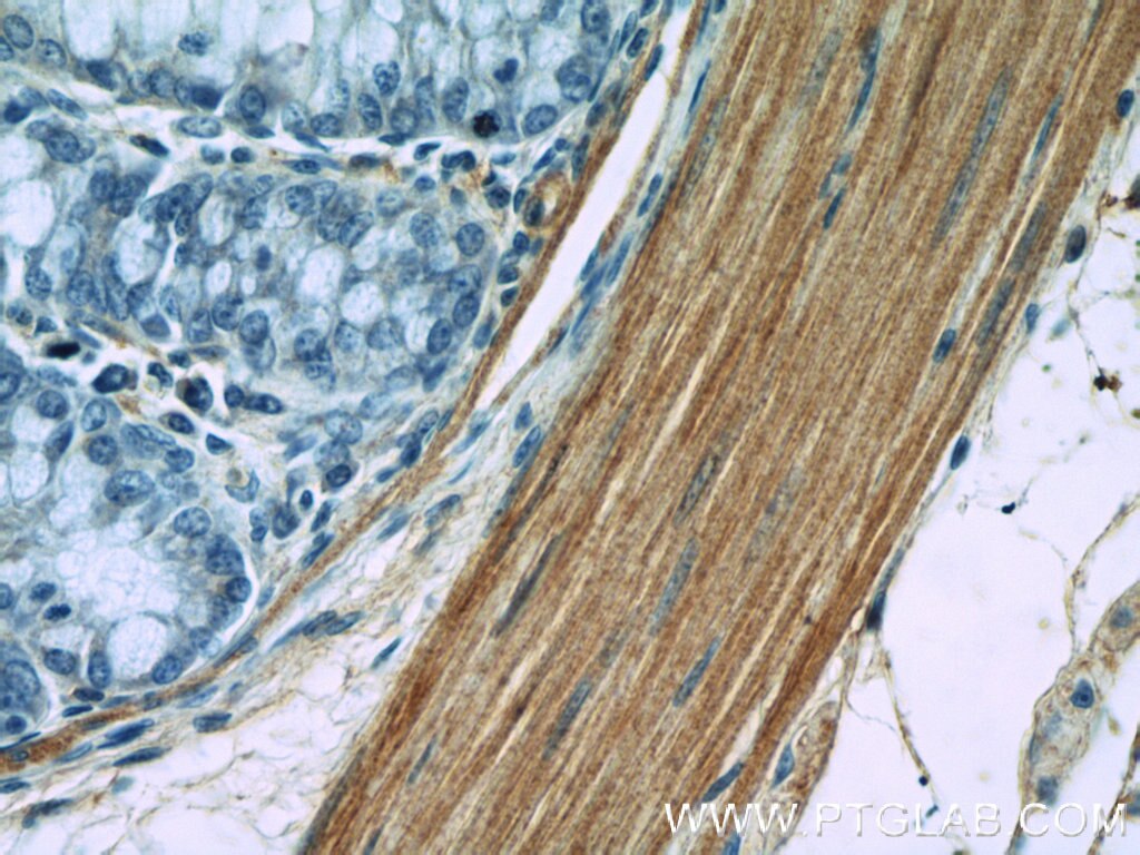 Alpha SMA-specific Antibody 55135-1-AP | Proteintech