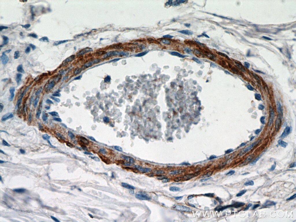 Alpha SMA-specific Antibody 55135-1-AP | Proteintech