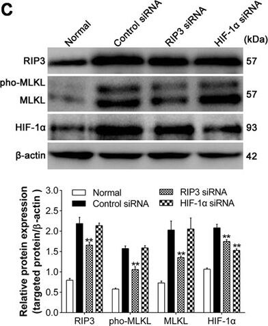 Beta Actin Antibody 20536-1-AP | Proteintech