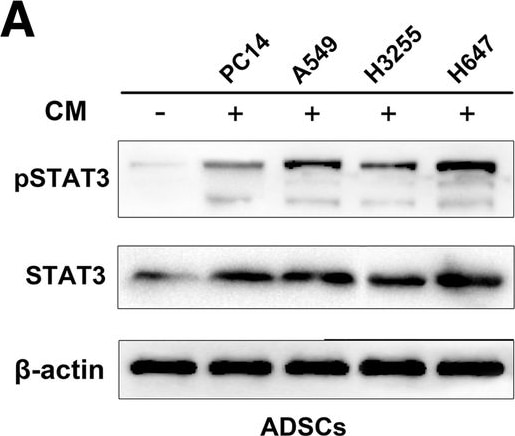 Beta Actin Antibody 20536-1-AP | Proteintech
