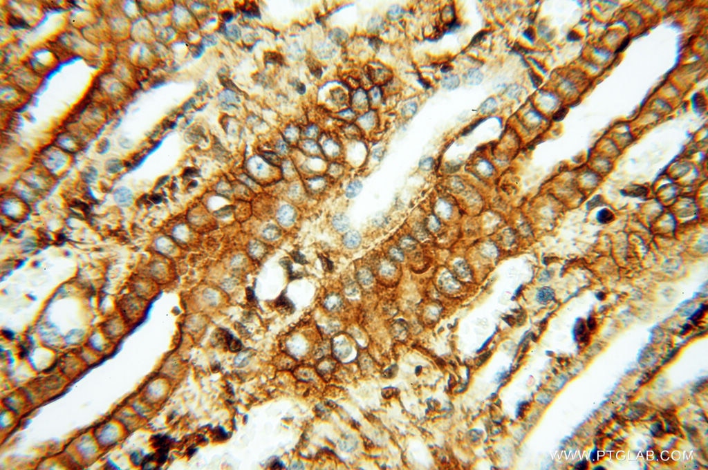 抗Beta-Actin（ACTB）鼠单克隆抗体_报价/价格/性能参数/图, Proteintech_生物器材网