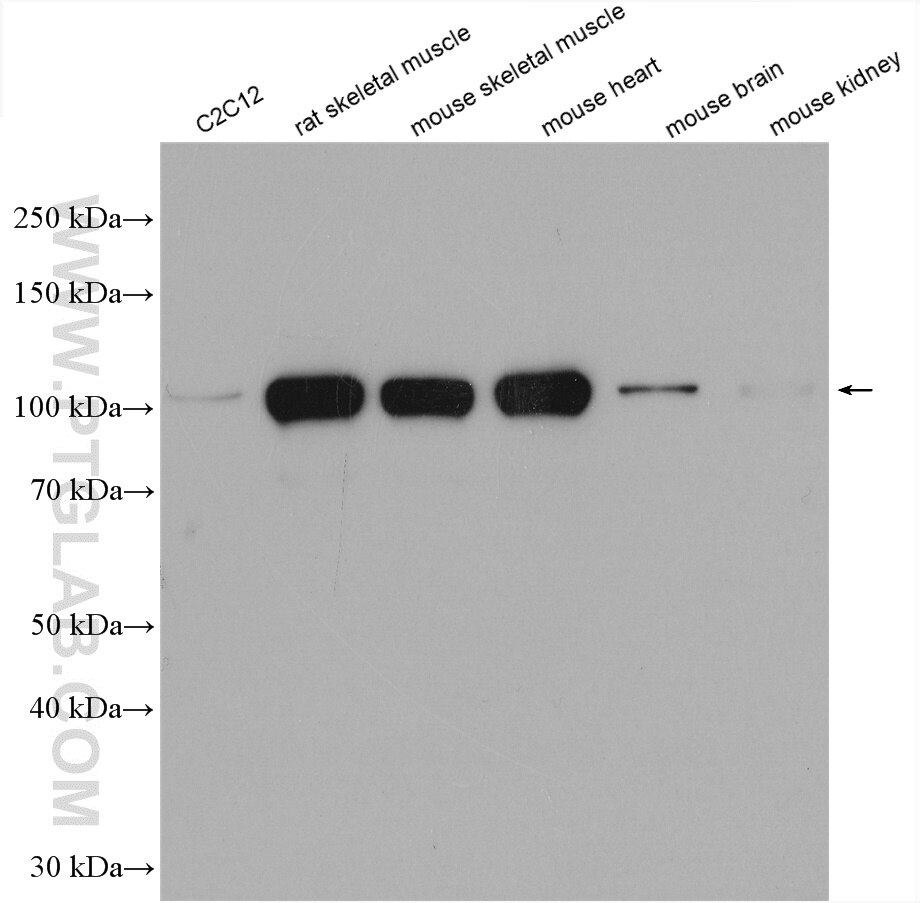 ACTN2 Antibody 14221-1-AP | Proteintech
