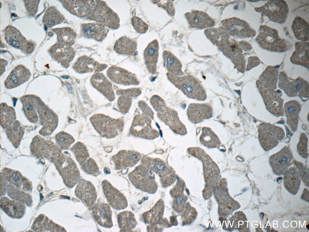 ADM2 Antibody 23781-1-AP | Proteintech