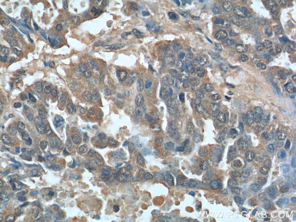 AFP antibody (14550-1-AP) | Proteintech
