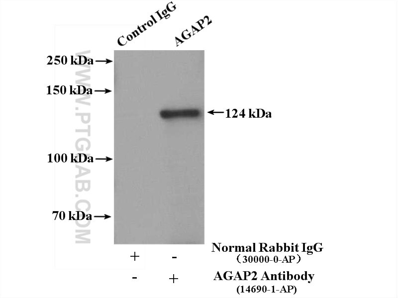 AGAP2 antibody (14690-1-AP) | Proteintech