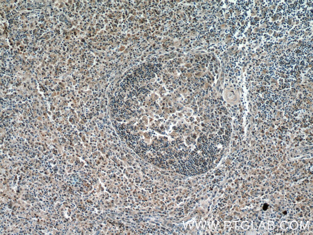 AKNA Antibody 23785-1-AP | Proteintech