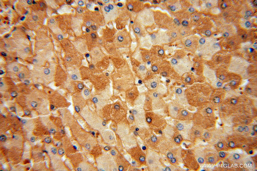 Albumin Antibody 16475-1-AP | Proteintech