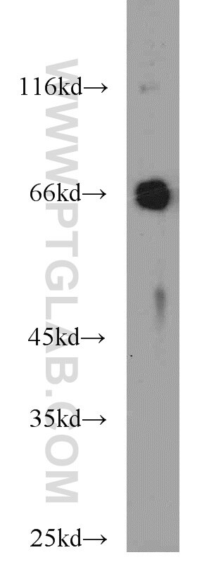 Albumin antibody (66051-1-Ig) | Proteintech