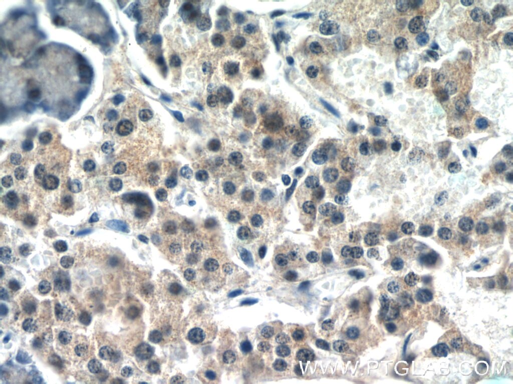 ALKBH1 antibody (13234-1-AP) | Proteintech