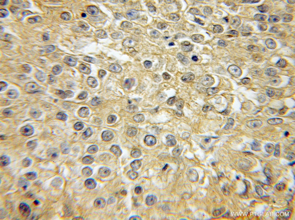 ALPL Antibody 11187-1-AP | Proteintech