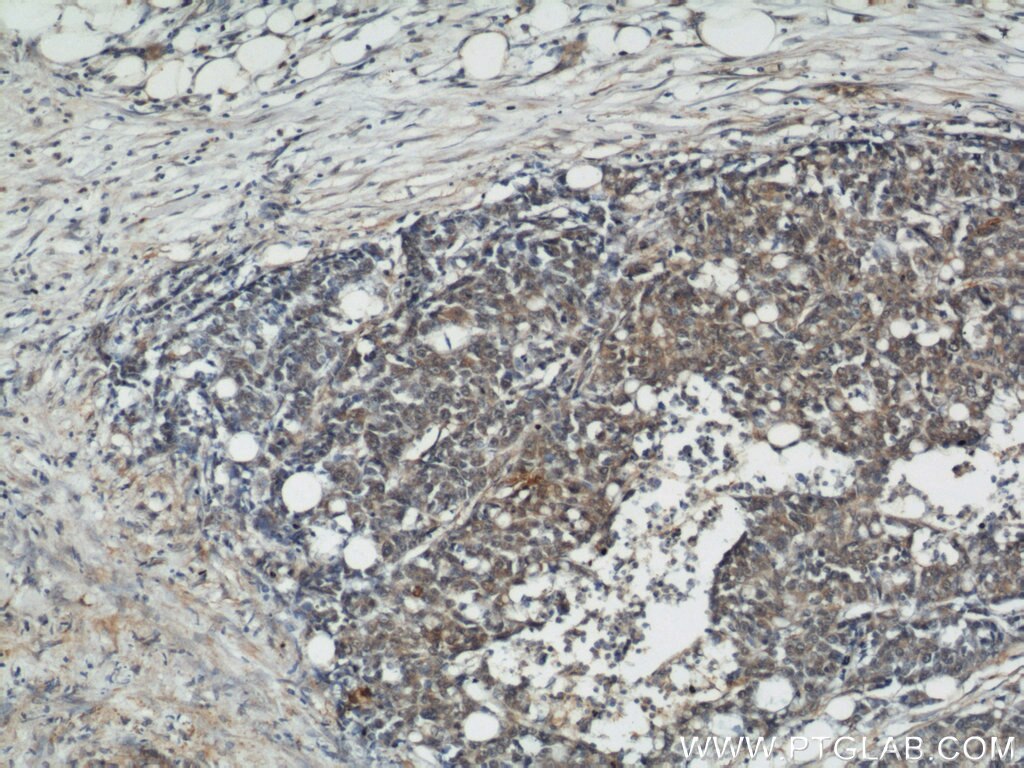 ALPL Antibody 11187-1-AP | Proteintech