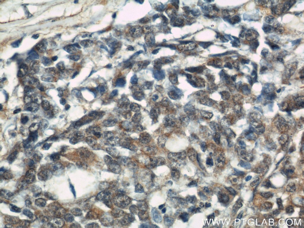 ALPL Antibody 11187-1-AP | Proteintech