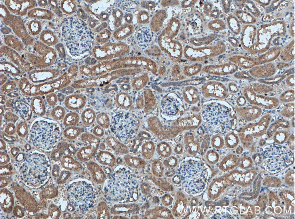 AP50 antibody (27355-1-AP) | Proteintech