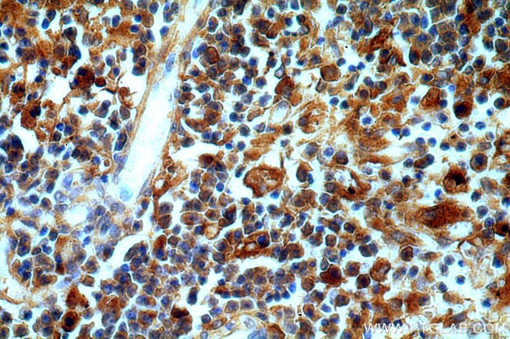 Serum amyloid P component antibody (20773-1-AP) | Proteintech