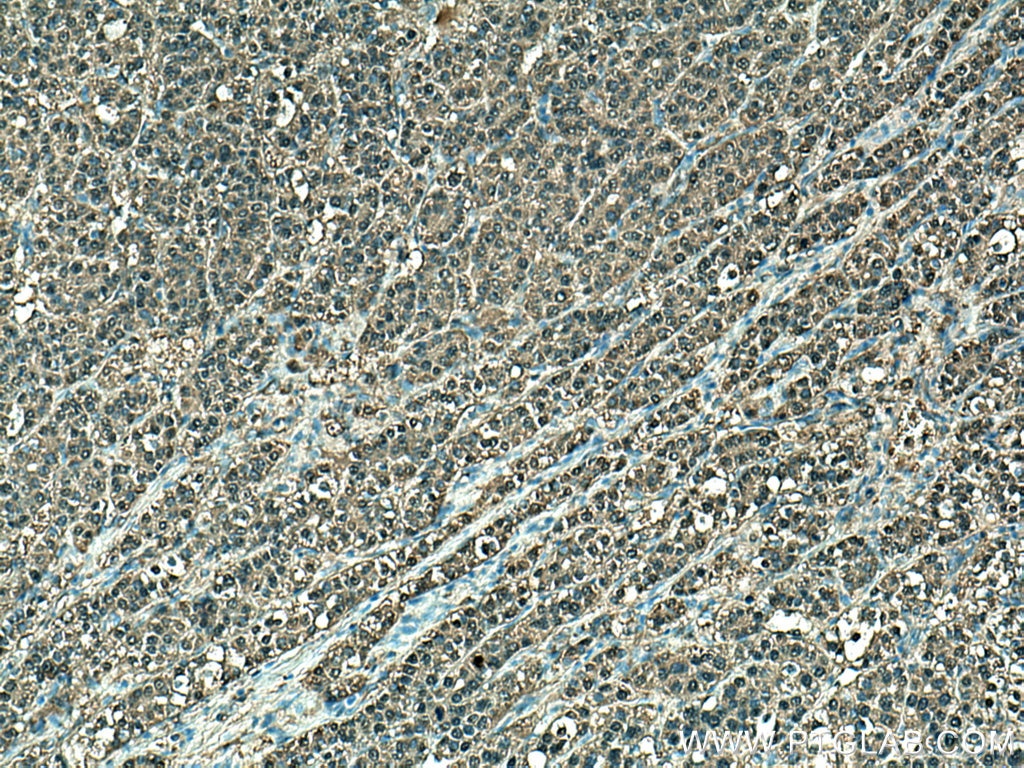 ARG1 Antibody 16001-1-AP | Proteintech