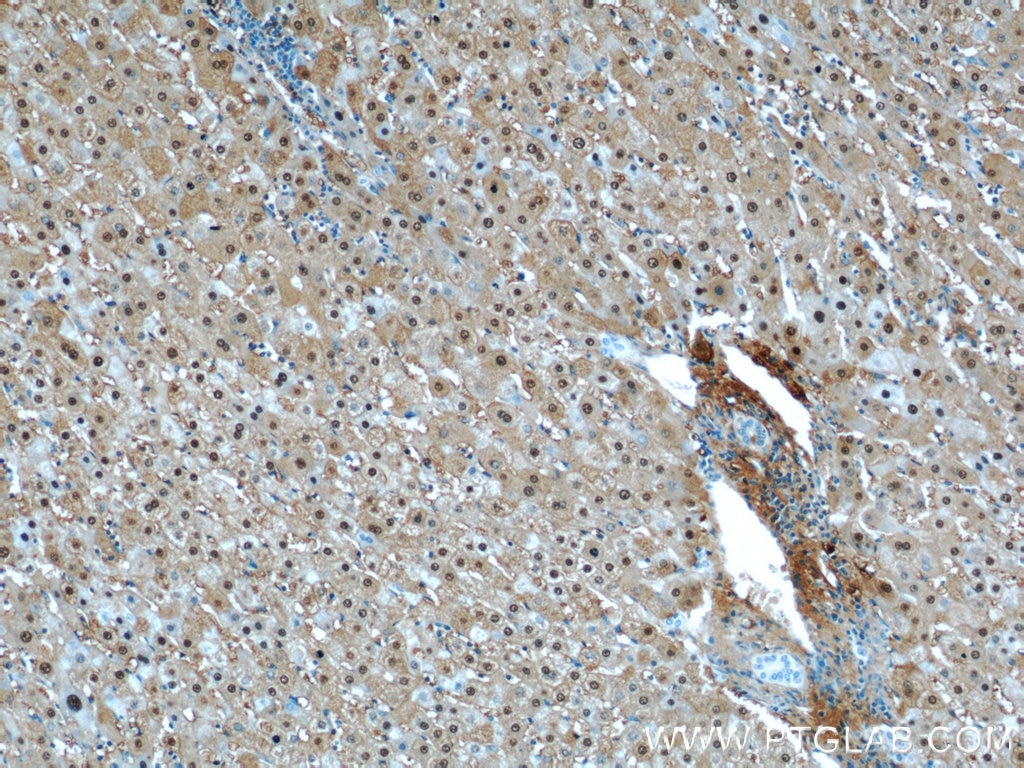 ARG1 Antibody 16001-1-AP | Proteintech