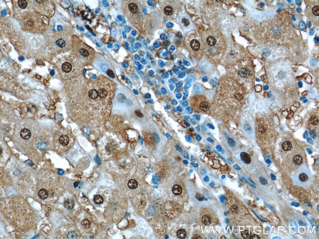 ARG1 Antibody 16001-1-AP | Proteintech