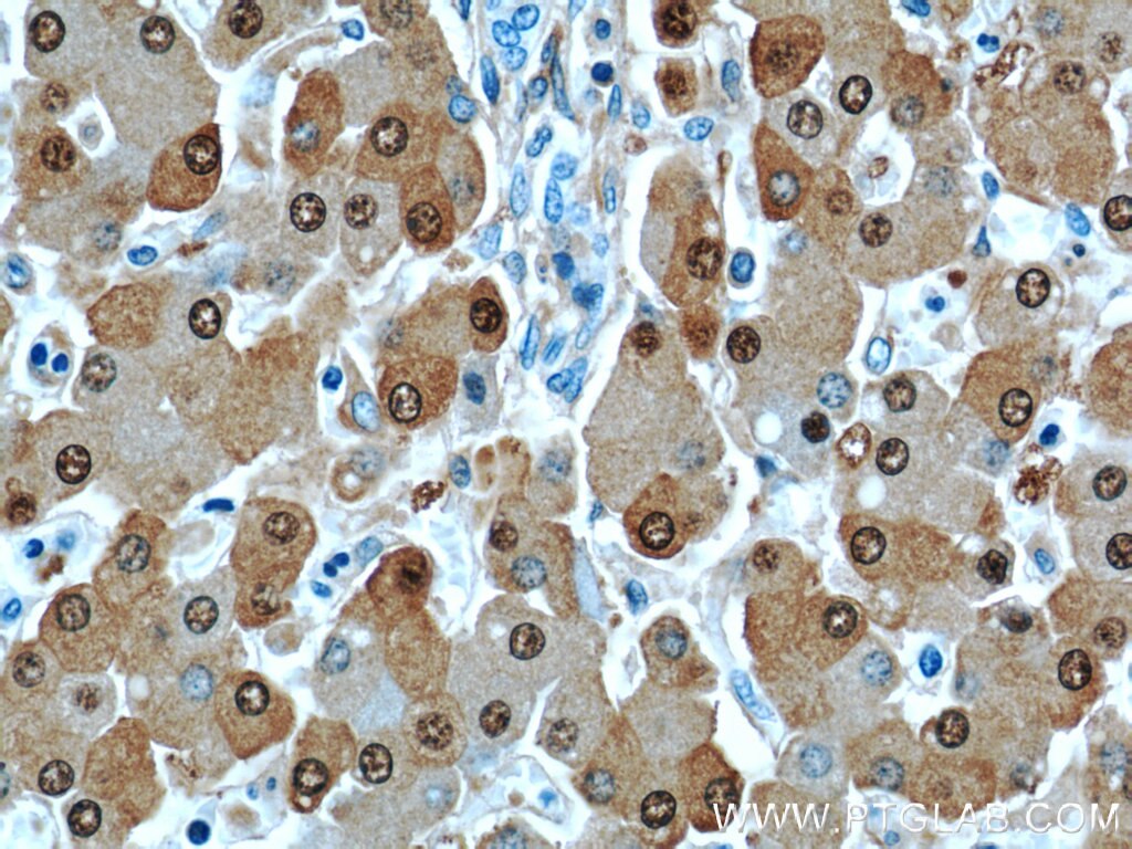 ARG1 Antibody 16001-1-AP | Proteintech