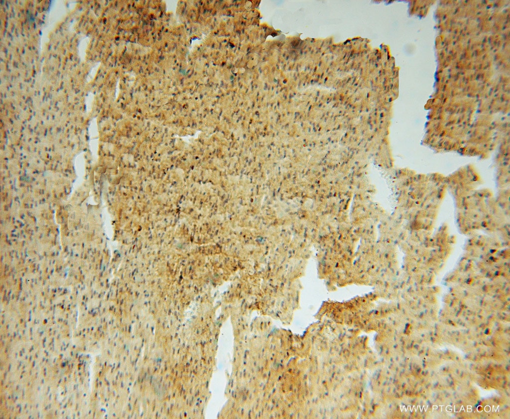 ARG1 Antibody 16001-1-AP | Proteintech