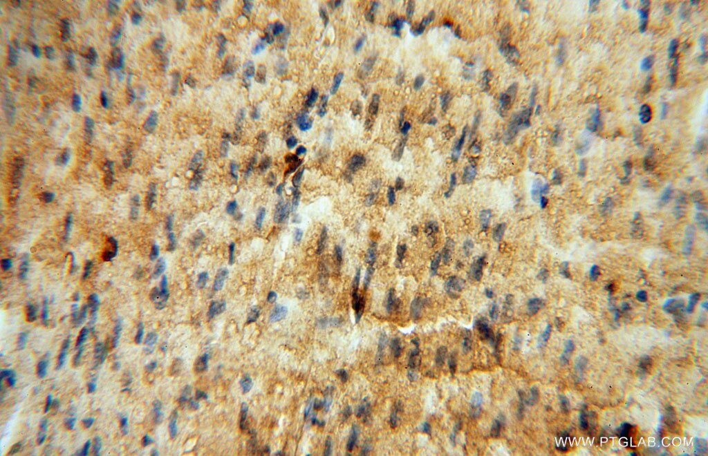 ARG1 Antibody 16001-1-AP | Proteintech