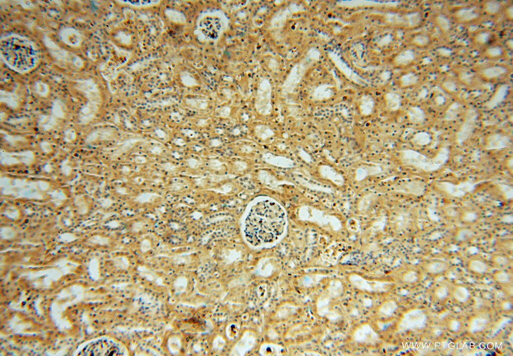 ARG1 Antibody 16001-1-AP | Proteintech