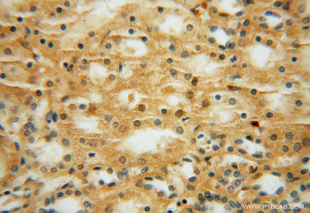 ARG1 Antibody 16001-1-AP | Proteintech