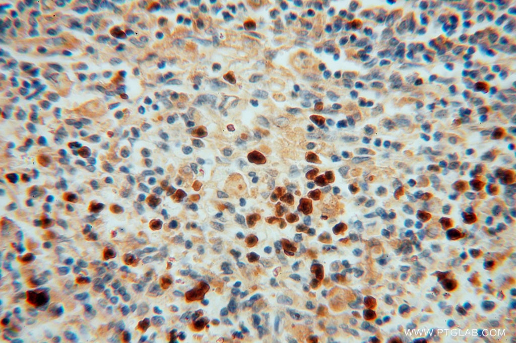 ARG1 Antibody 16001-1-AP | Proteintech