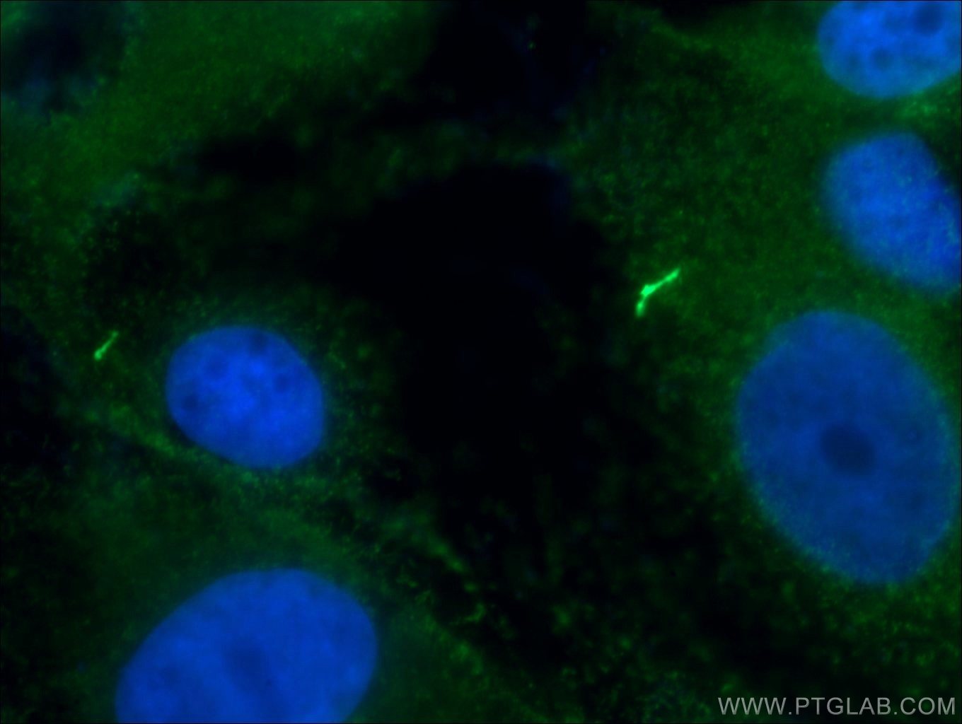 ARL13B Antibody 17711-1-AP | Proteintech