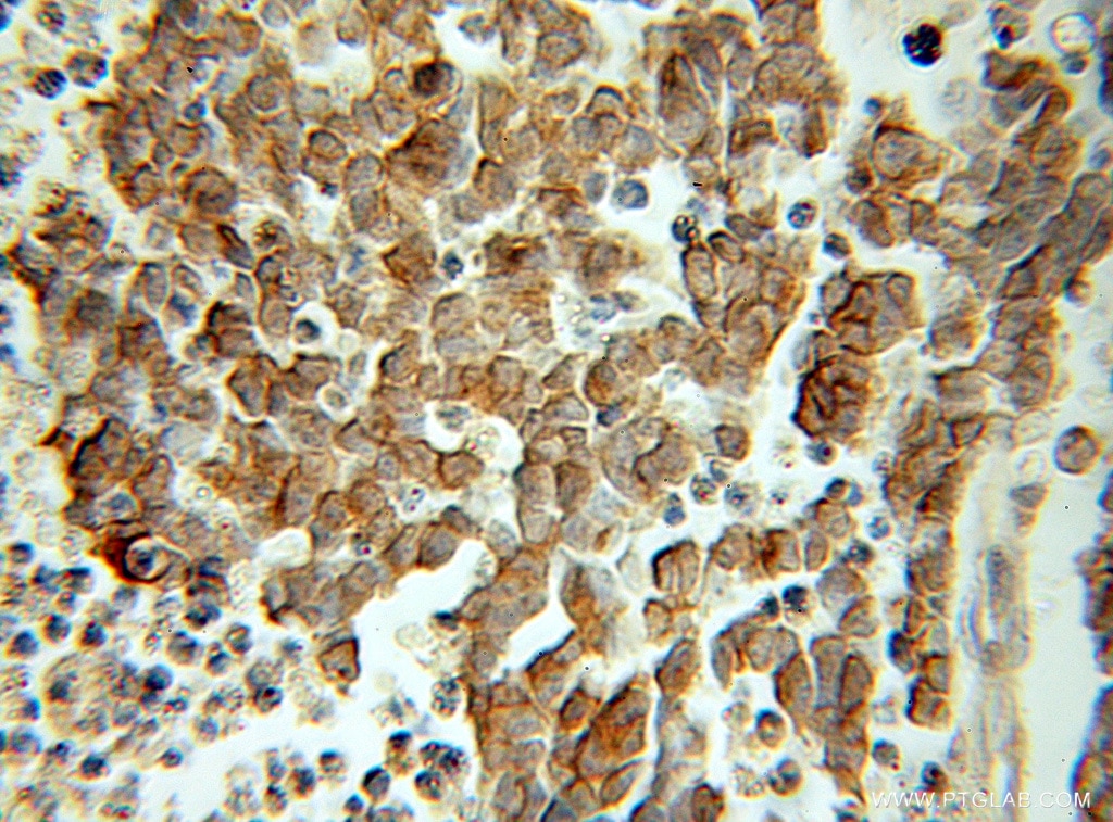 Retinal cone arrestin-3 Antibodies | AntibodyResource.com
