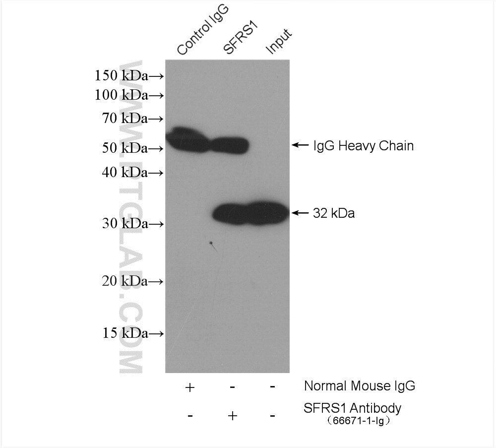 ASF/SF2 antibody (66671-1-Ig) | Proteintech