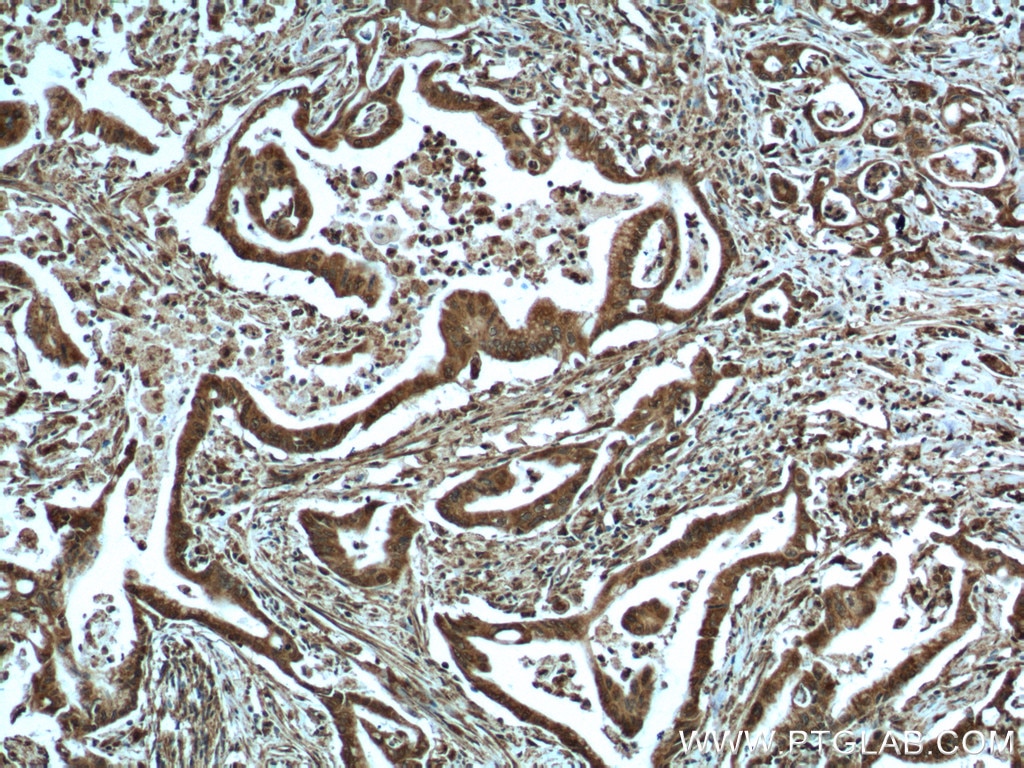 ATF4 antibody (60035-1-Ig) | Proteintech