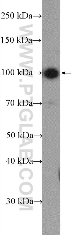 ATF6 Antibody 24169-1-AP | Proteintech